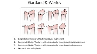 Colles Fracture Classification