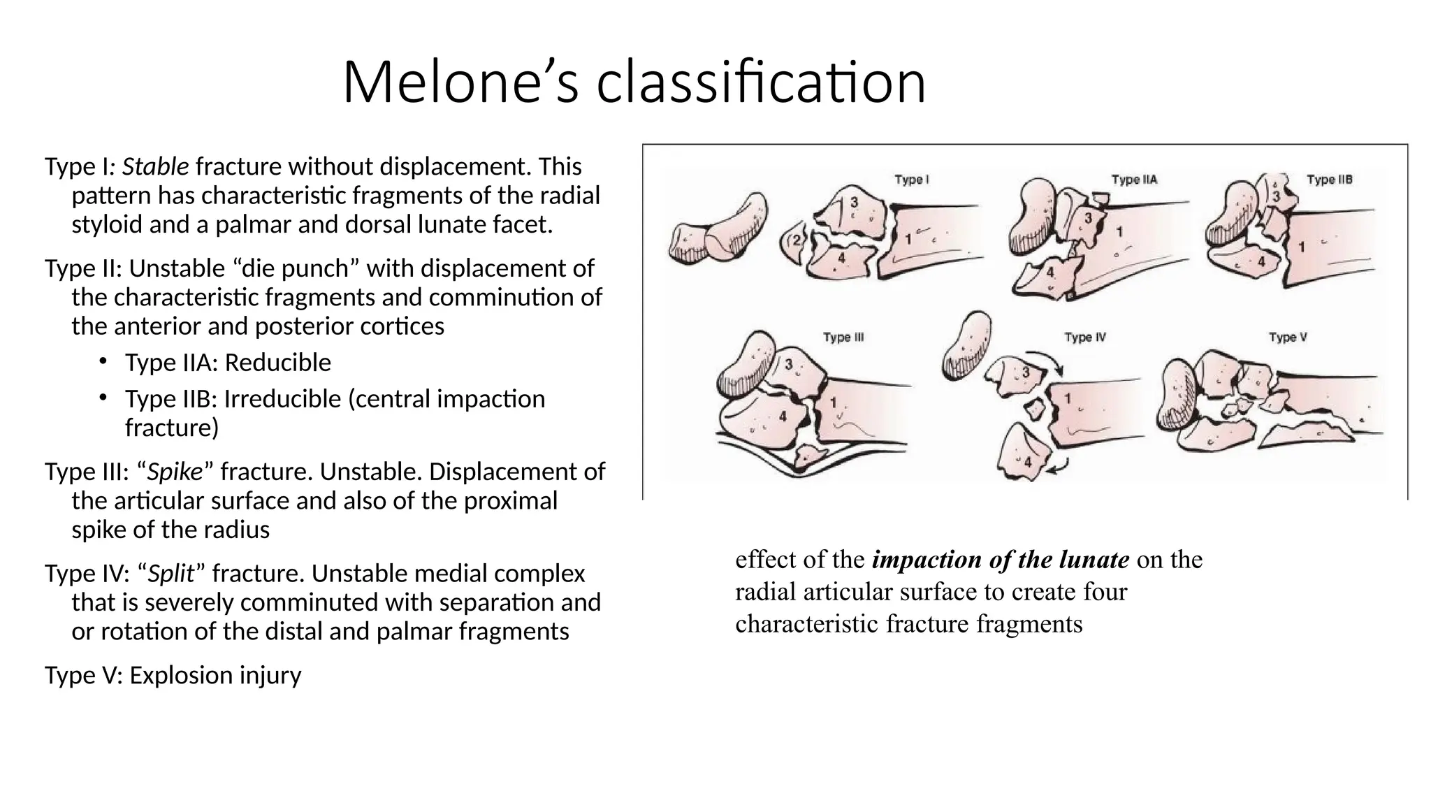 fracturesofdistalendradius-Dr waqas.pptx