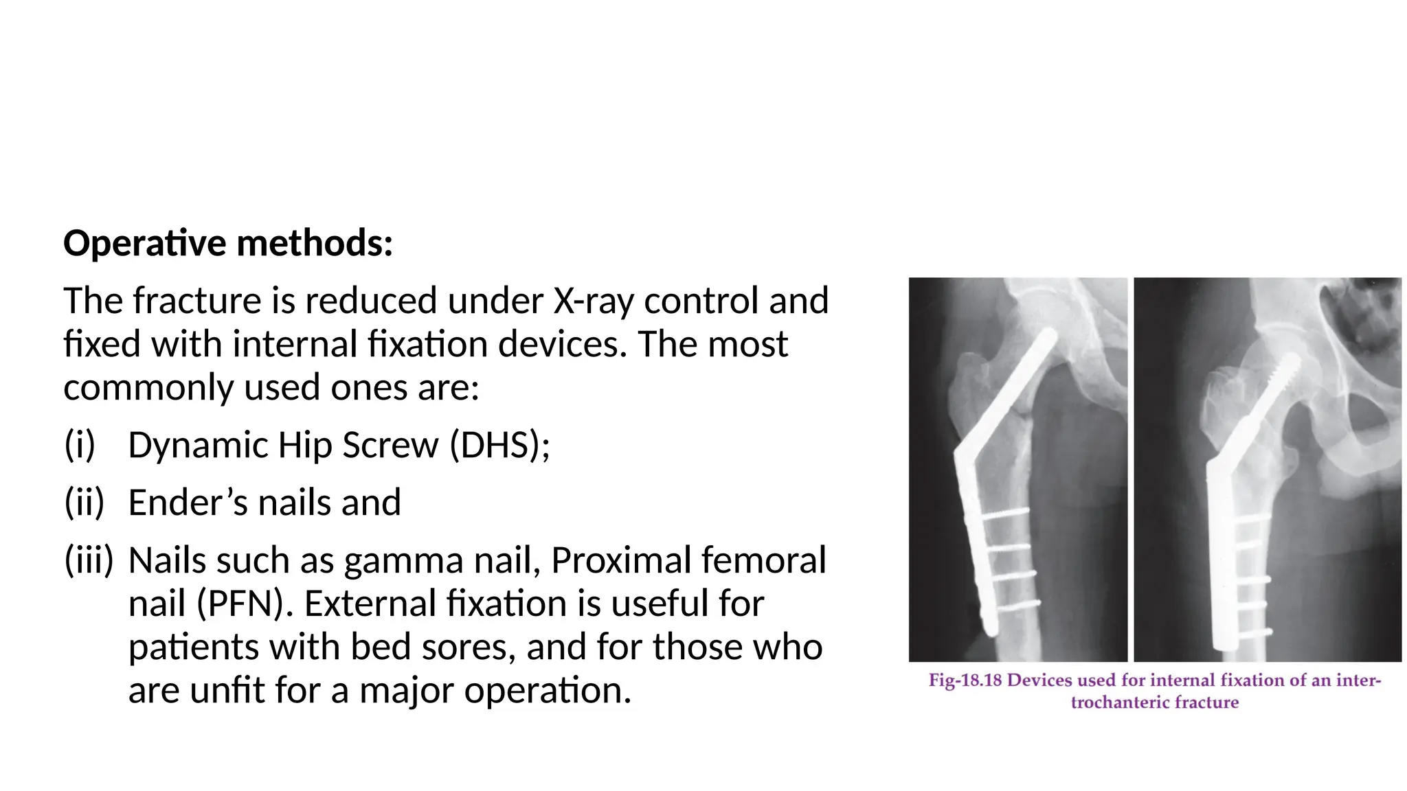 Hip Fractures: Types & Management // Fractures of Hip | PPTX