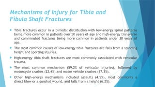 Fractures of Leg and Foot orthopedics campbell | PPTX