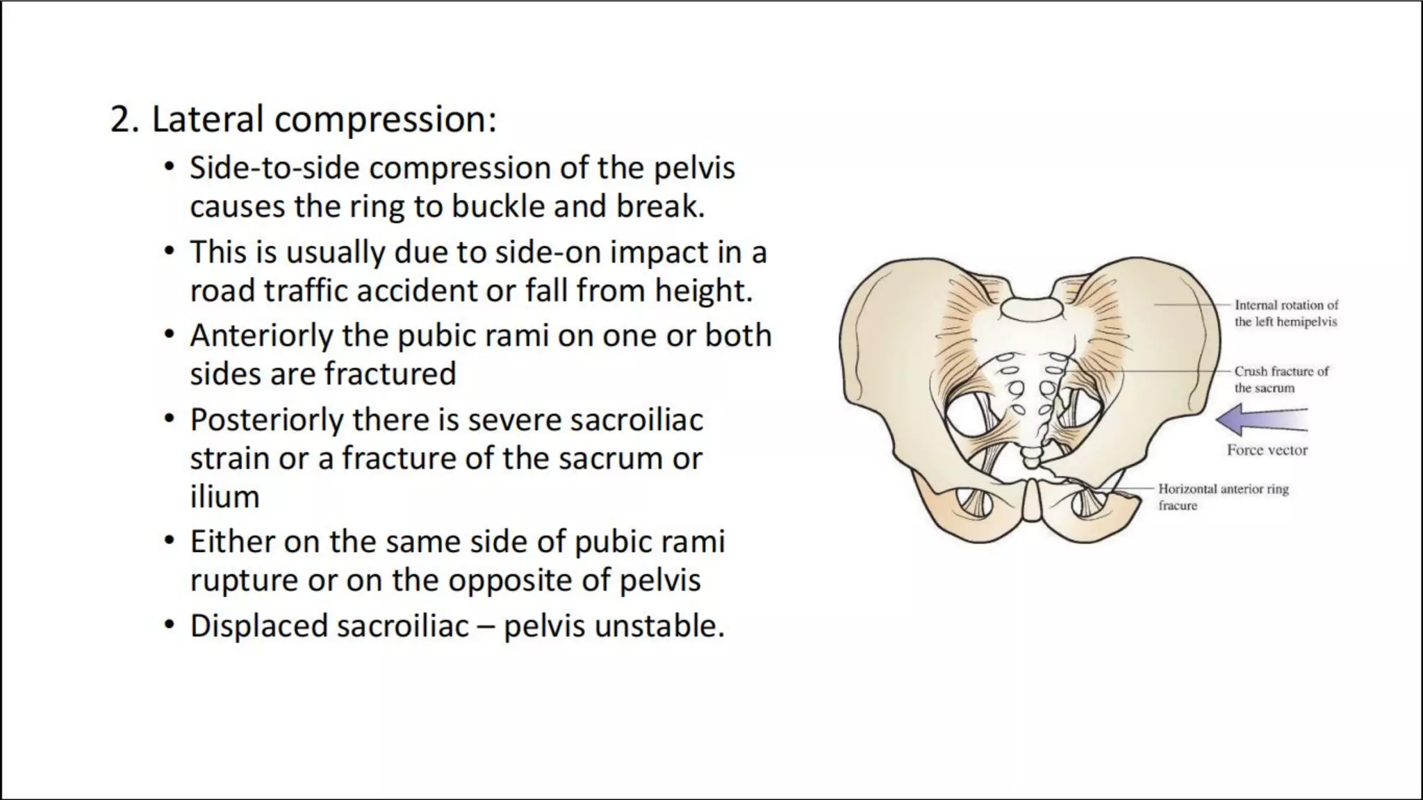 FRACTURES OF LOWER LIMB 1.pdf