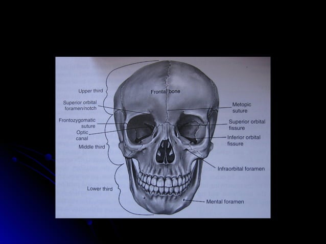 Fractures of middle third of facial skeleton ih | PPT | First Aid ...