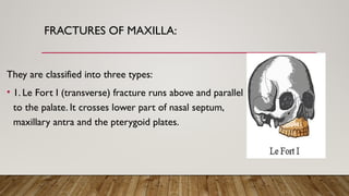 Fractures of Orbital Floor and Maxilla.pptx