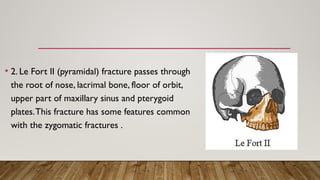 Fractures of Orbital Floor and Maxilla.pptx