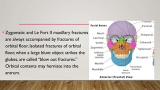 Fractures of Orbital Floor and Maxilla.pptx
