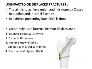 FRACTURES OF PROXIMAL FEMUR ORTHOPEDICS.pptx