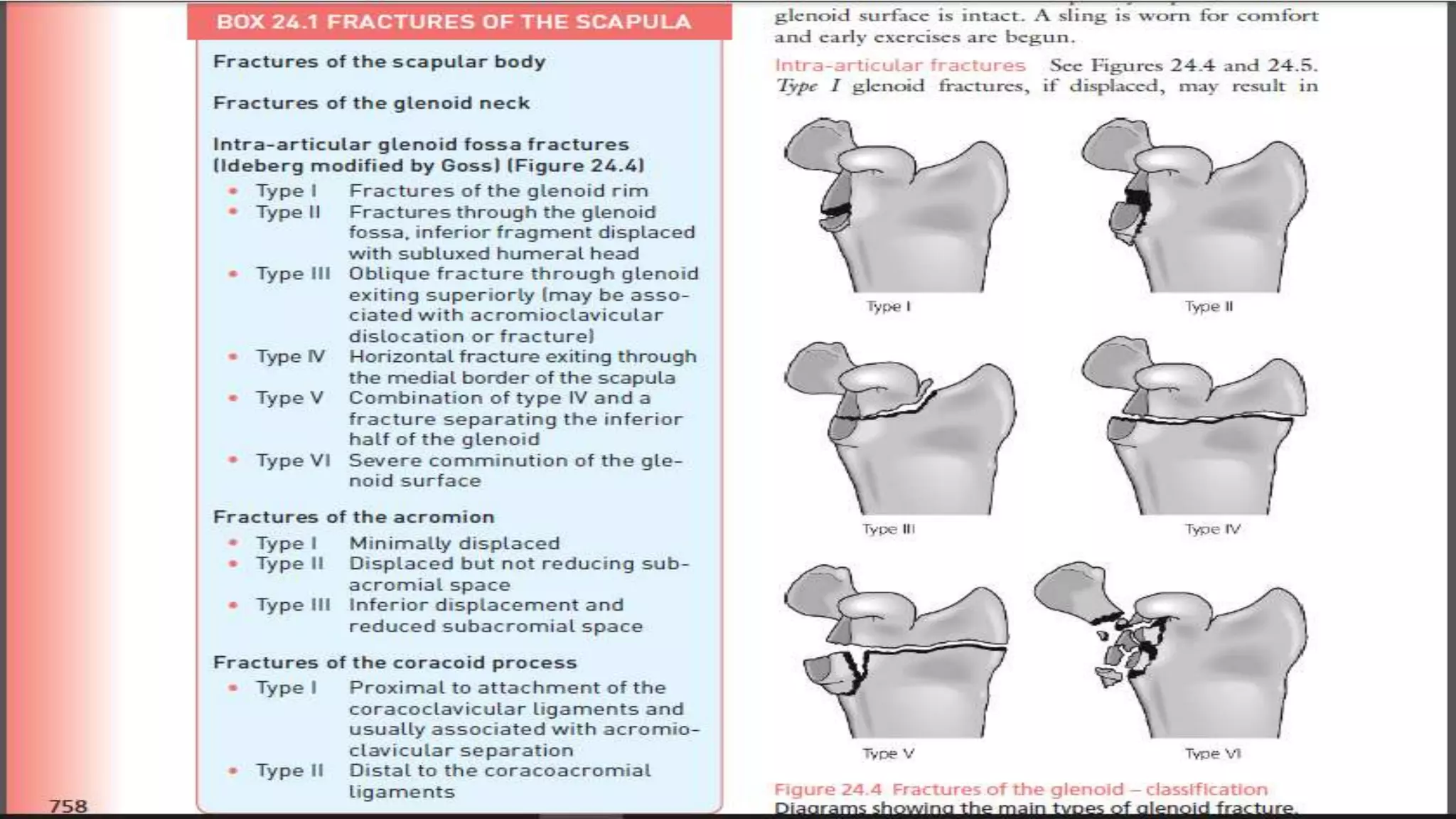 Fractures of scapula | PPTX