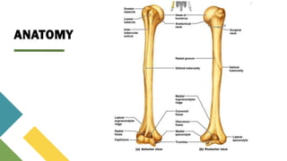 FRACTURES OF SHAFT OF HUMERUS - ORTHOPEDICS PRESENTATION | PDF