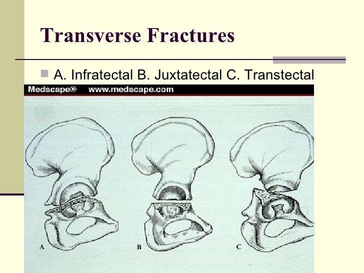 Orthopedics 5th year, 2nd lecture (Dr. Ali A.Nabi)