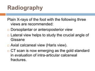 Fractures of the calcaneum.pptx. . | PPTX