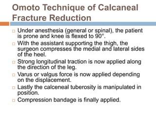 Fractures of the calcaneum.pptx. . | PPTX