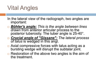 Fractures of the calcaneum.pptx. . | PPTX