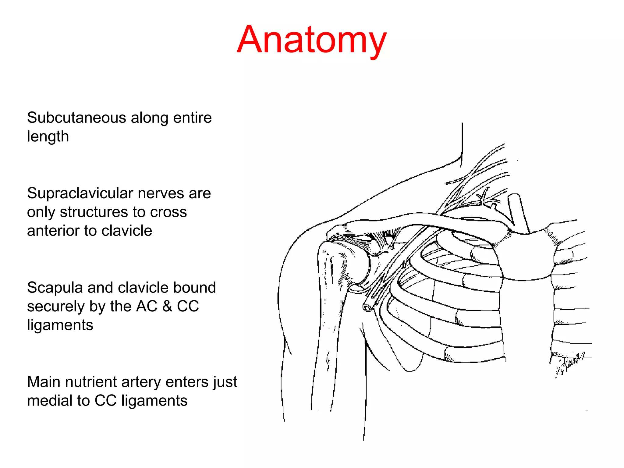 Fractures of the clavicle | PPT