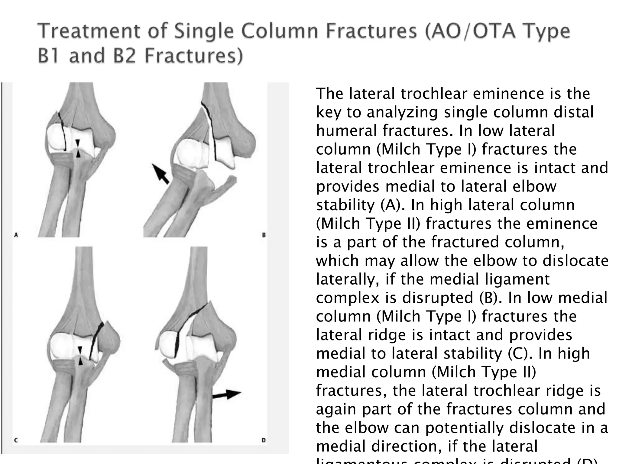 Fractures of the distal humerus ppt | PPTX
