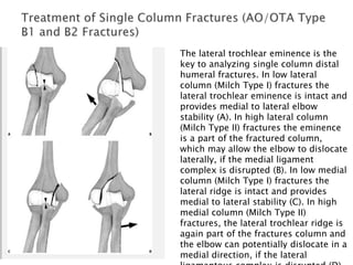 Fractures of the distal humerus ppt | PPTX