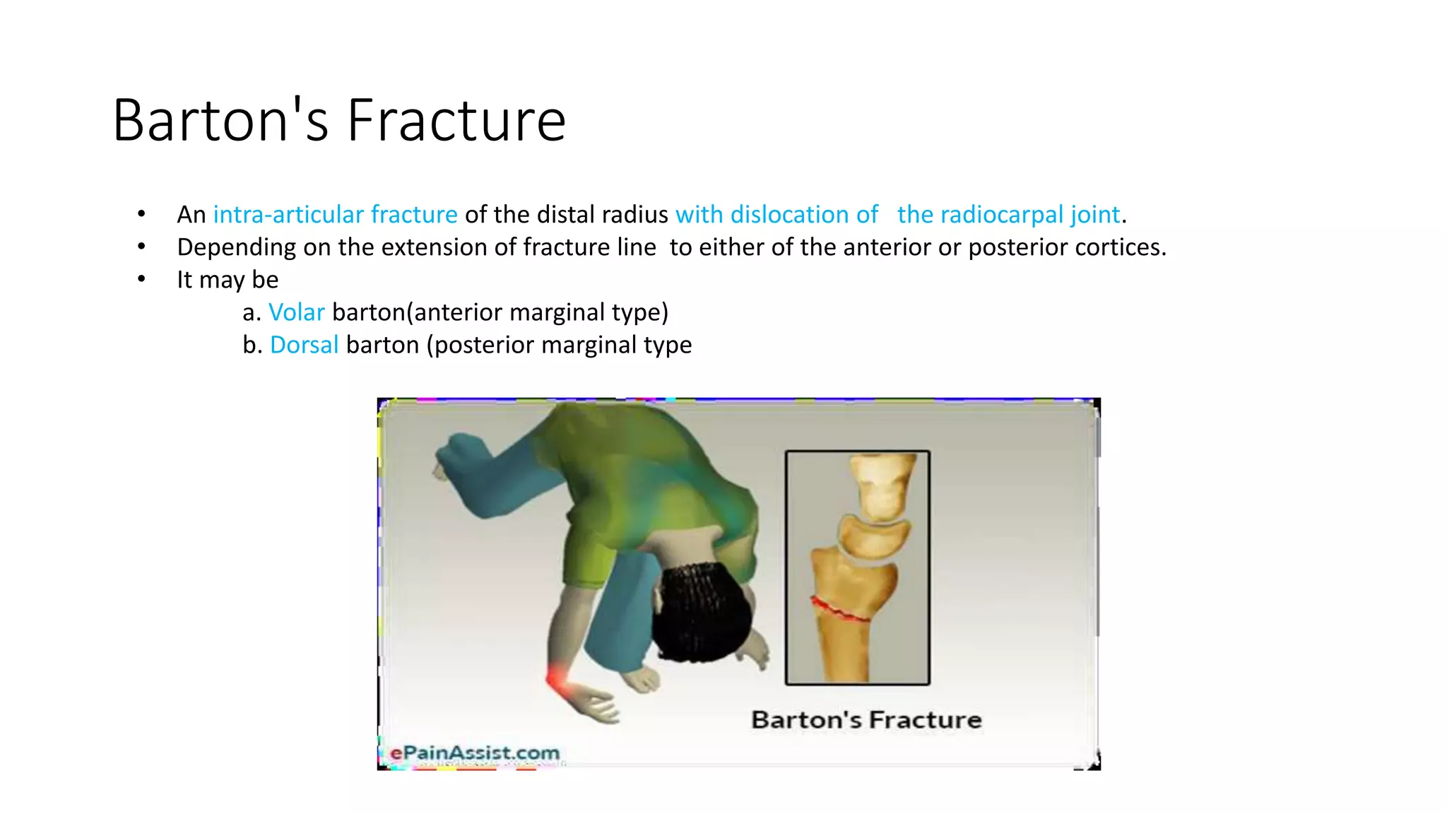 Fractures of the distal radial physis and barton's fracture | PPT