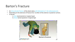 Fractures of the distal radial physis and barton's fracture | PPTX