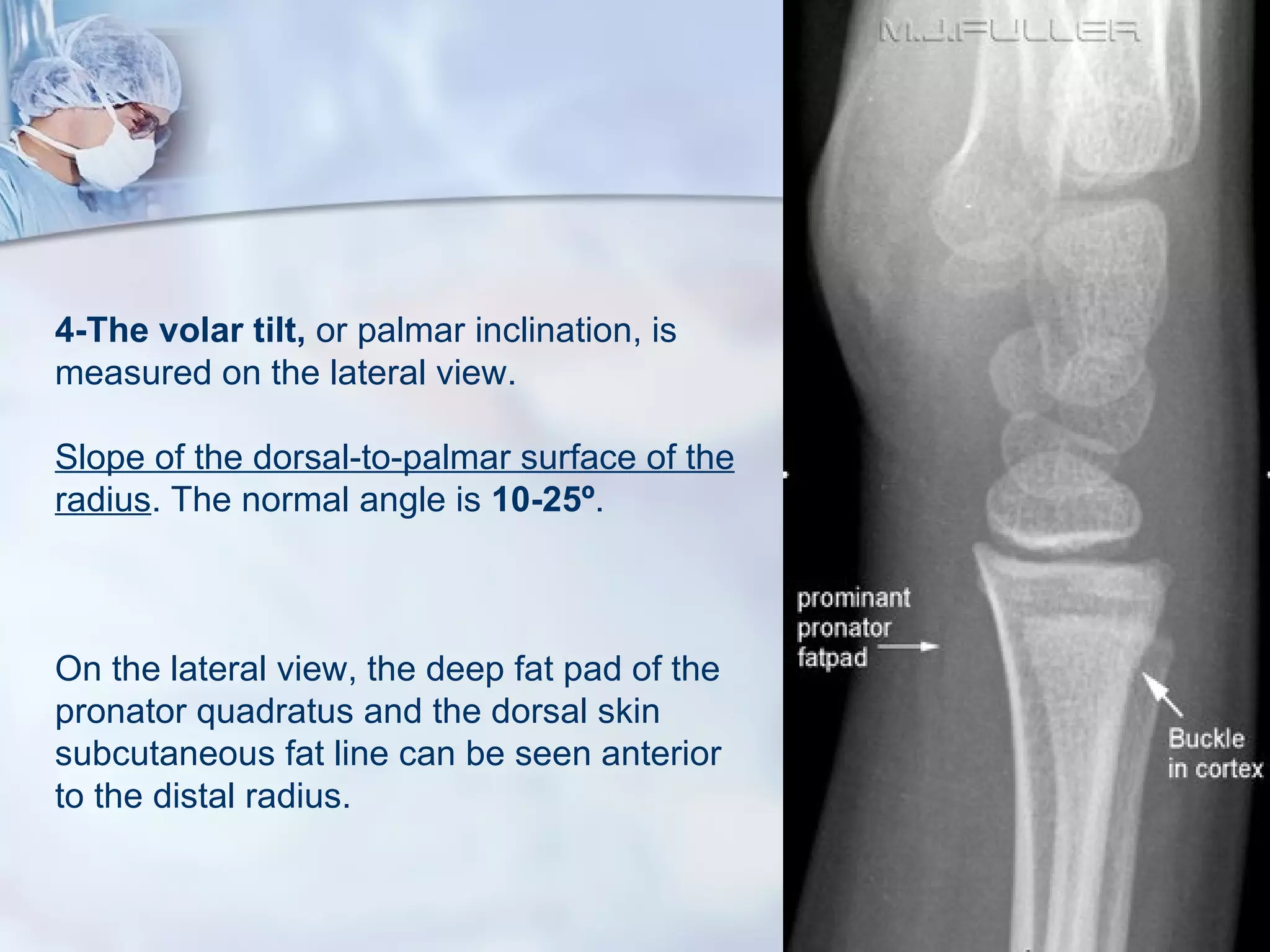 Fractures Of The Distal Radius | PPT