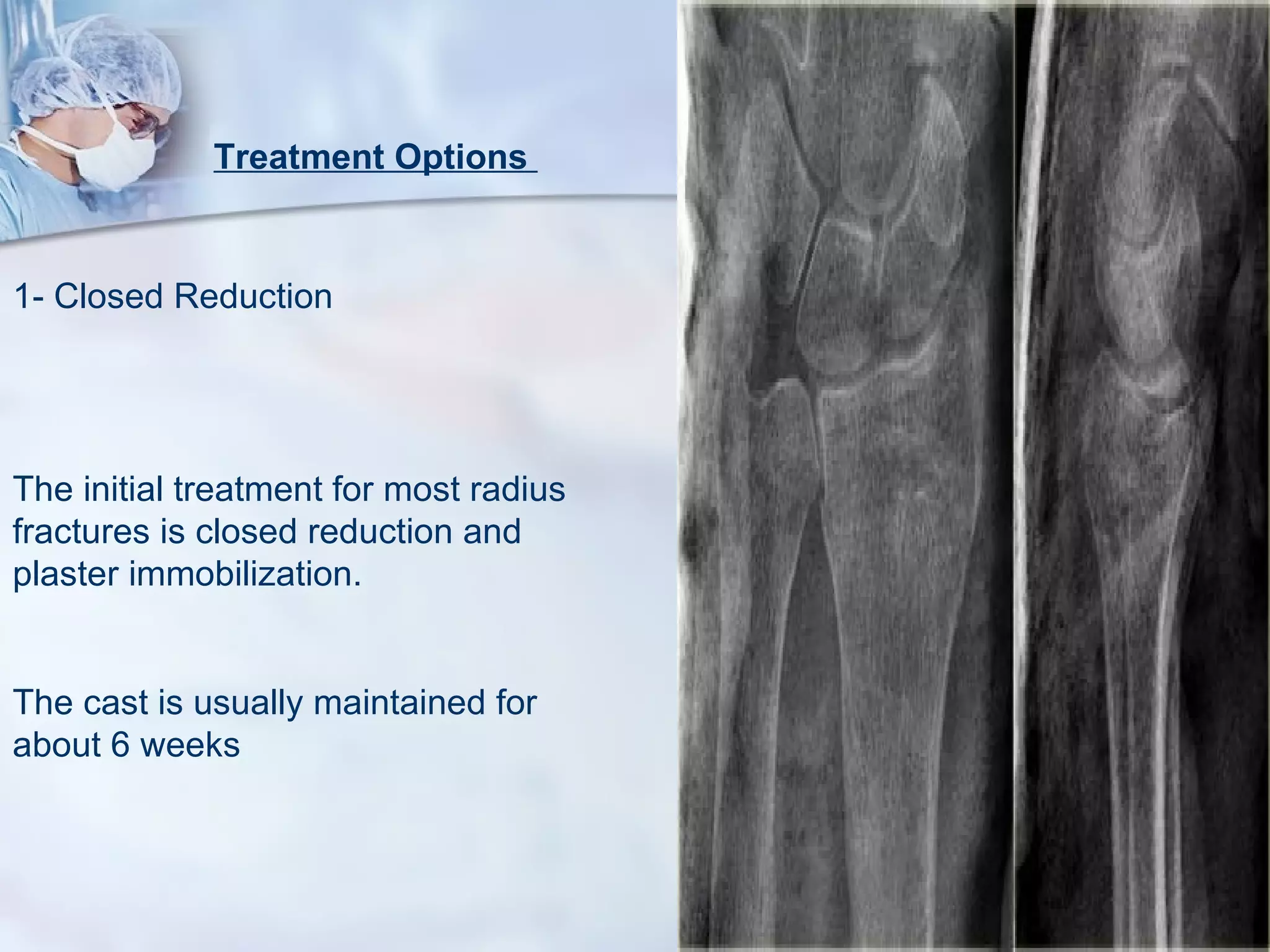 Fractures Of The Distal Radius | PPT