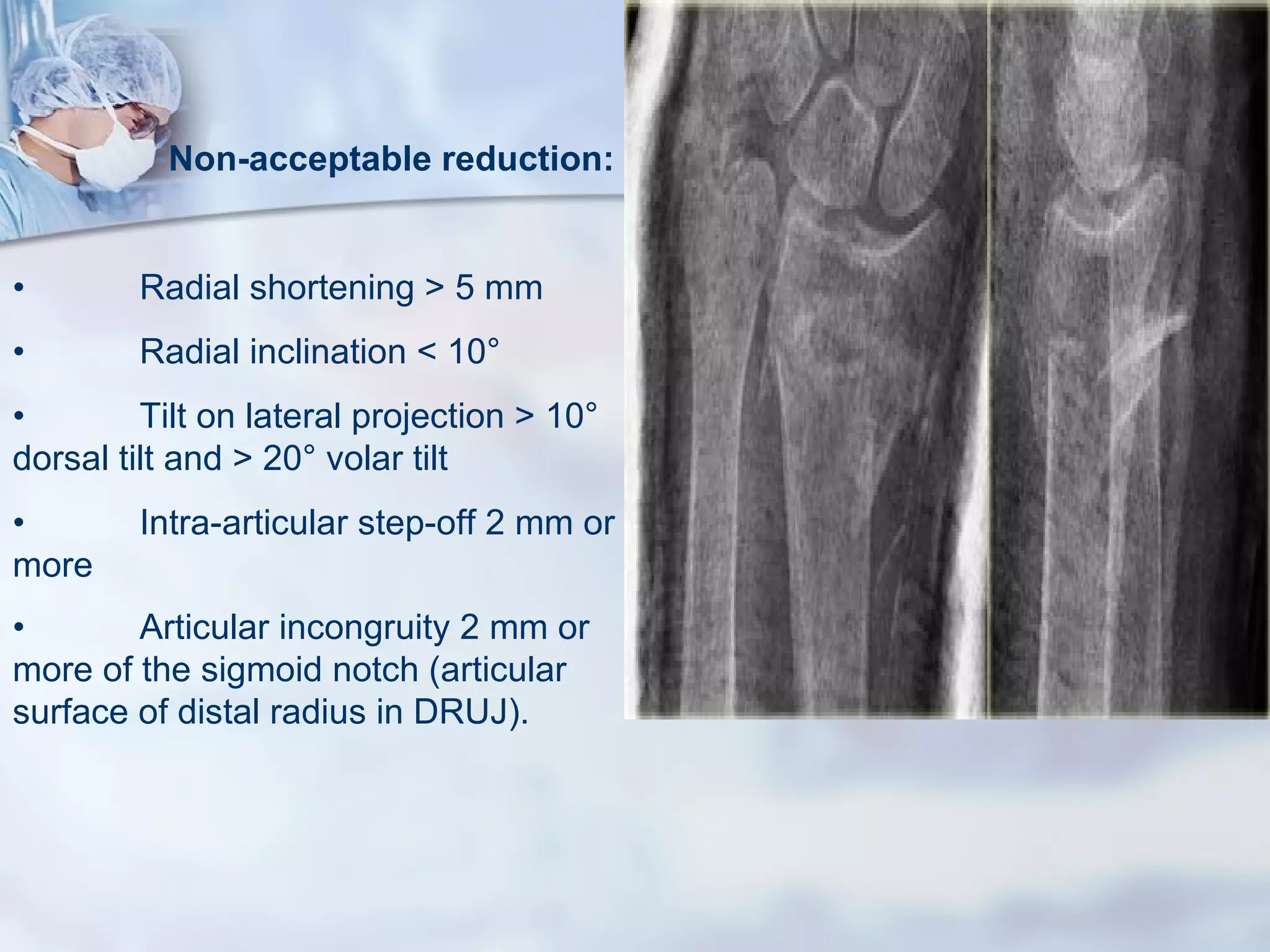 Fractures Of The Distal Radius | PPT