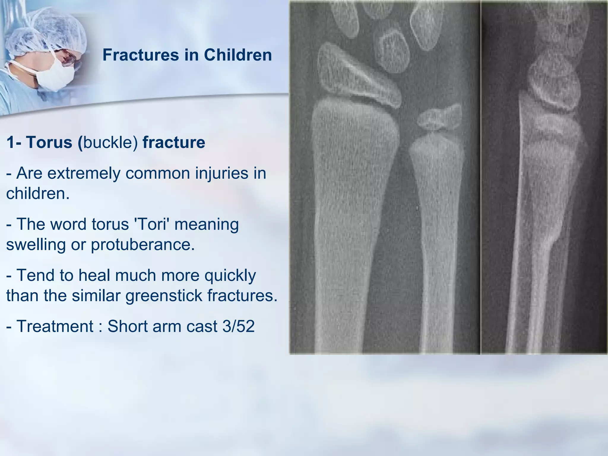 Fractures Of The Distal Radius | PPT