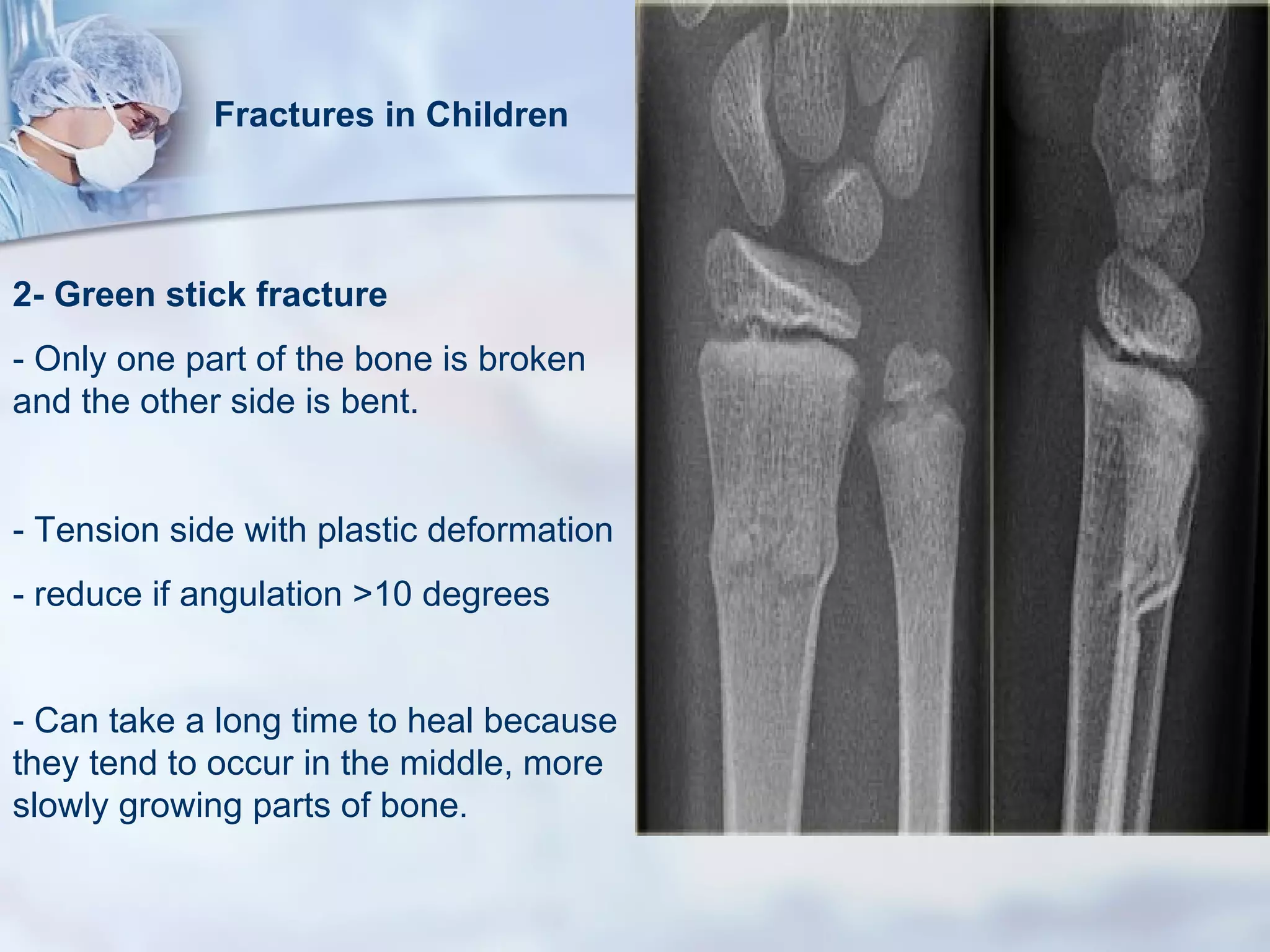 Fractures Of The Distal Radius | PPT