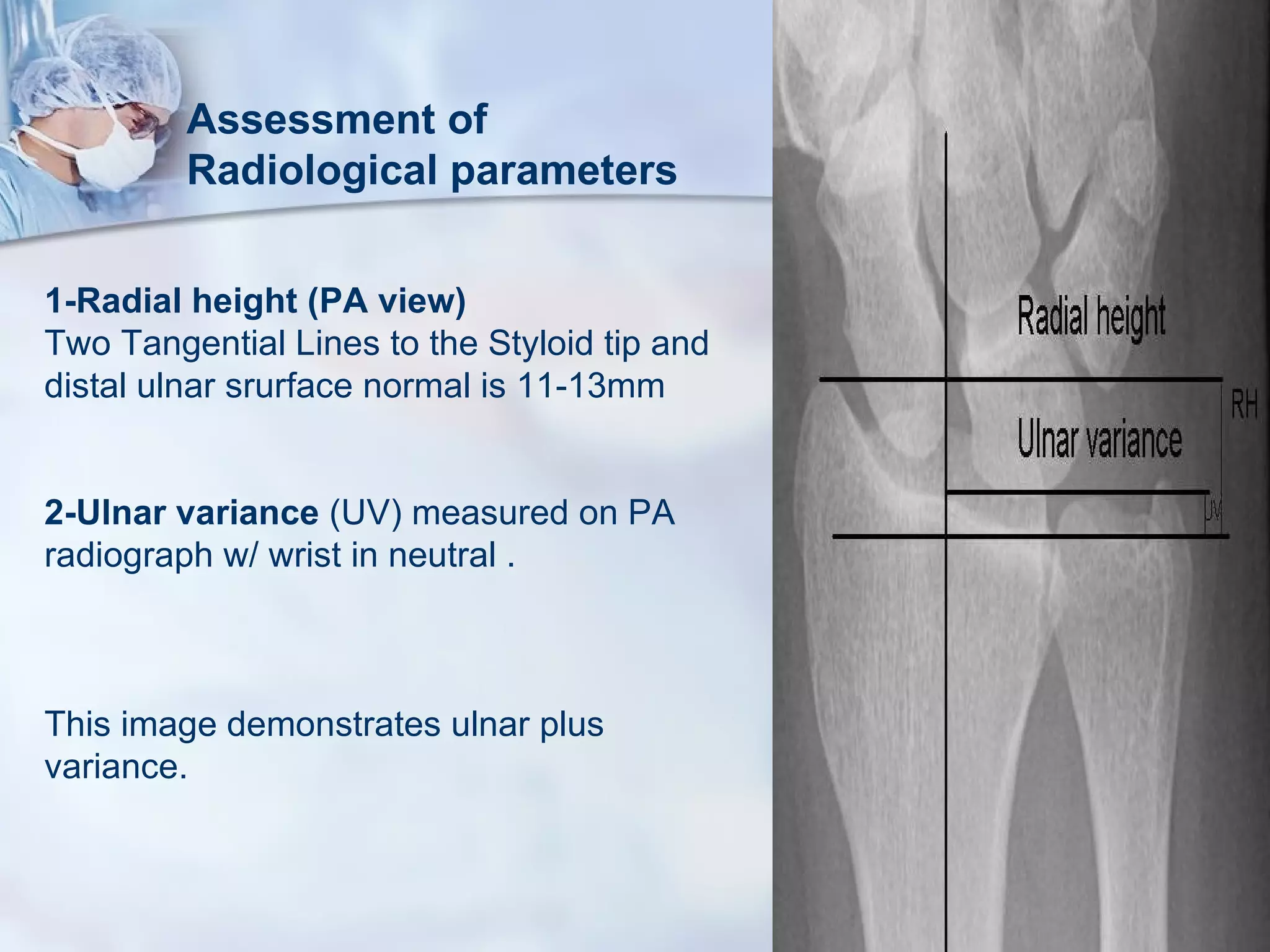 Fractures Of The Distal Radius | PPT