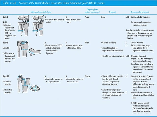 Fractures Of The Distal Radius | PPT
