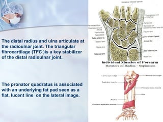 Fractures Of The Distal Radius | PPT