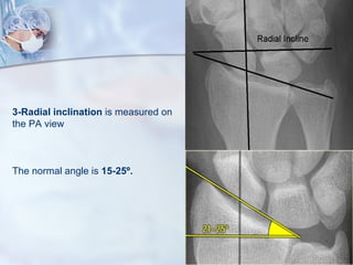 Fractures Of The Distal Radius | PPT