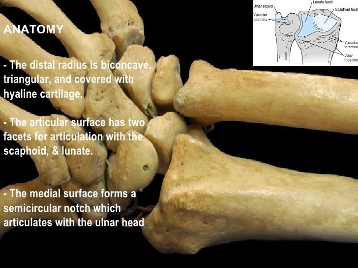 Fractures Of The Distal Radius