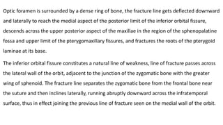 Fractures of the Middle-third of the Facial Skeleton (1).pptx