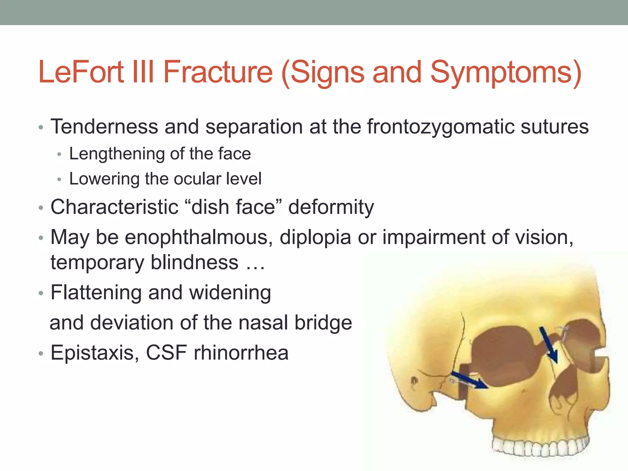 Fractures of the Middle third of the Facial Skeleton | PPTX