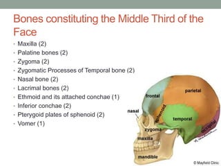 Fractures of the Middle third of the Facial Skeleton | PPTX