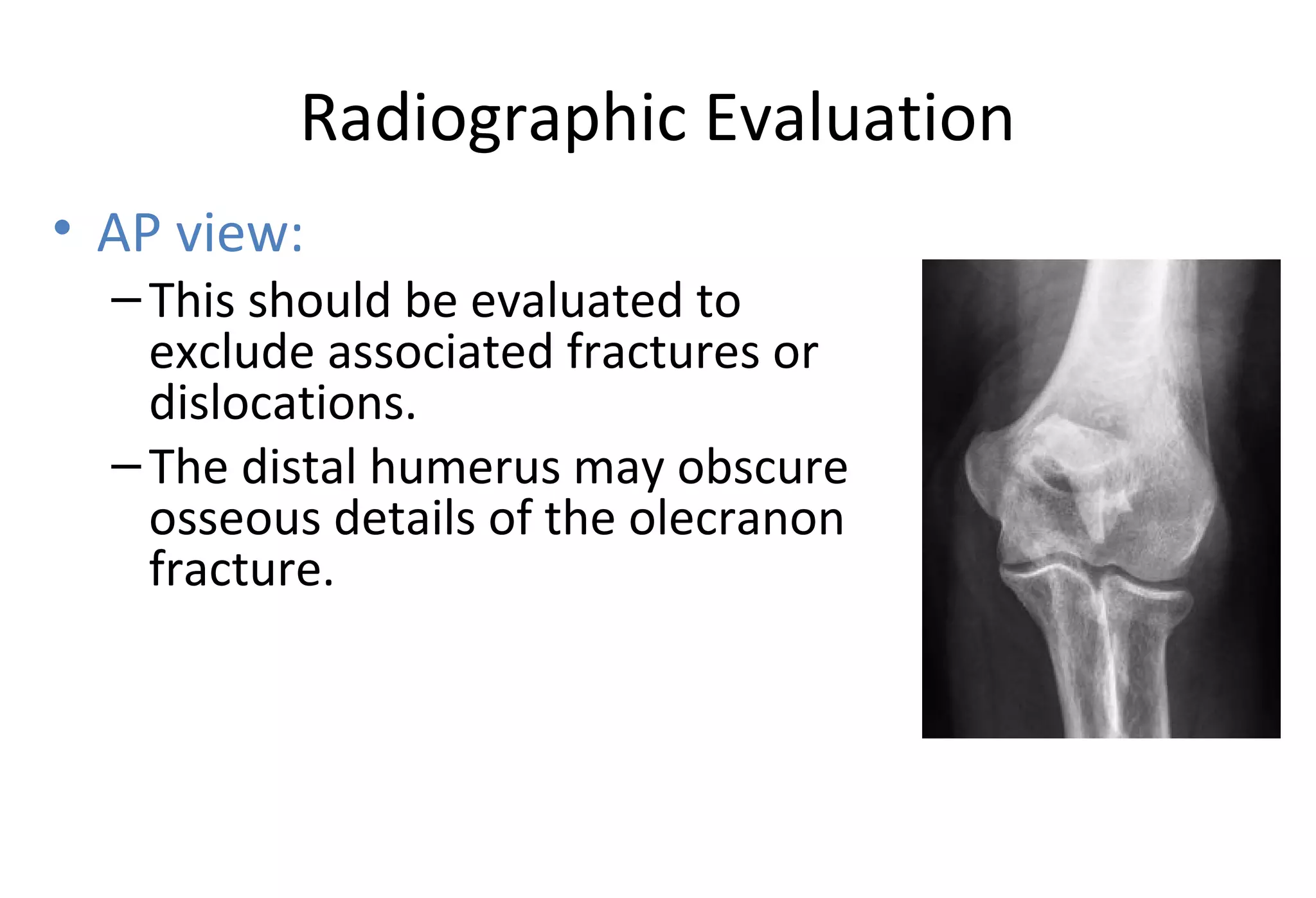 Fractures of the olecranon | PPT