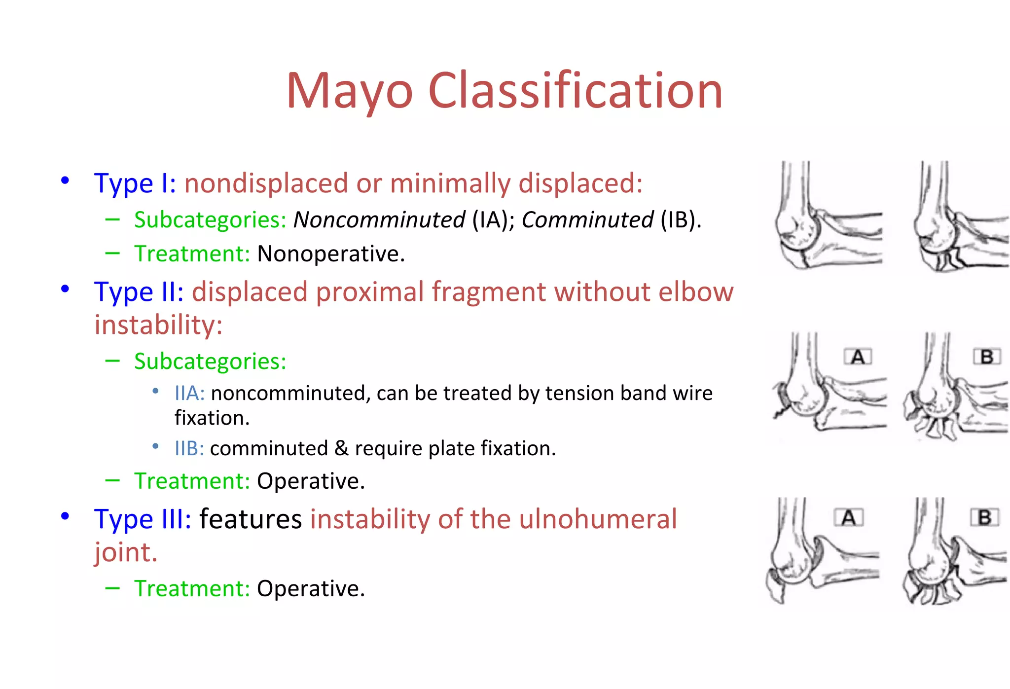 Fractures of the olecranon | PPT