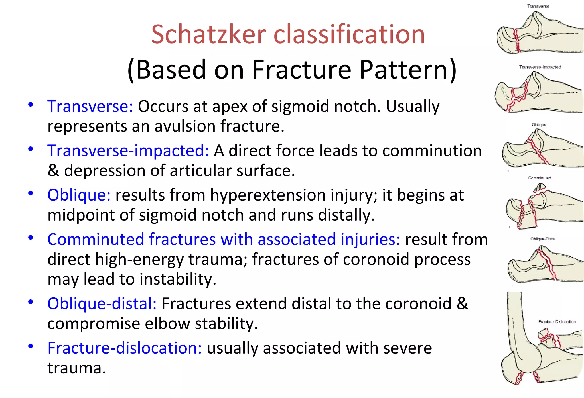 Fractures of the olecranon | PPT