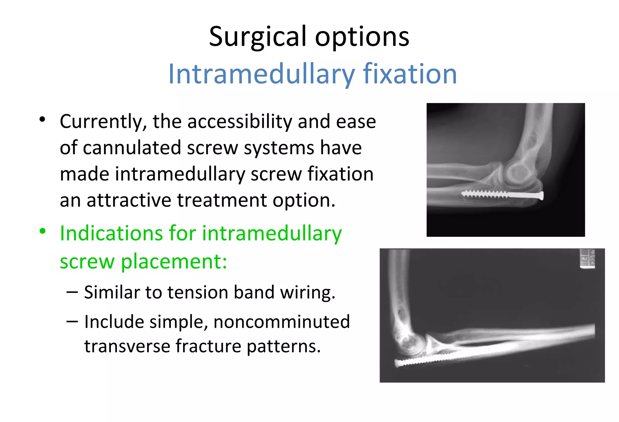 Fractures of the olecranon | PPT