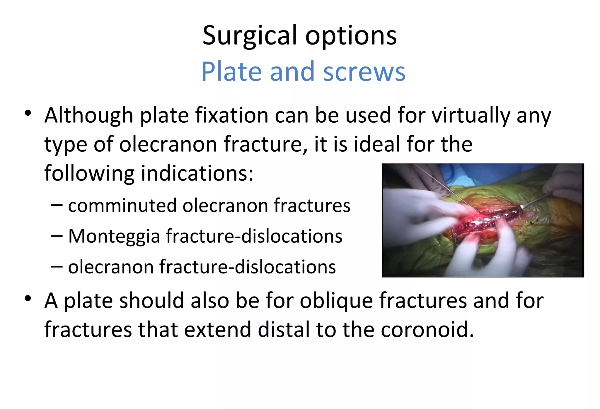 Fractures of the olecranon | PPT