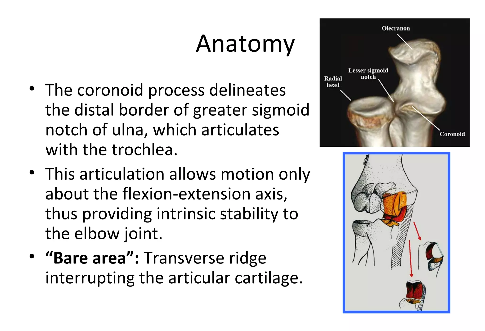 Fractures of the olecranon | PPT