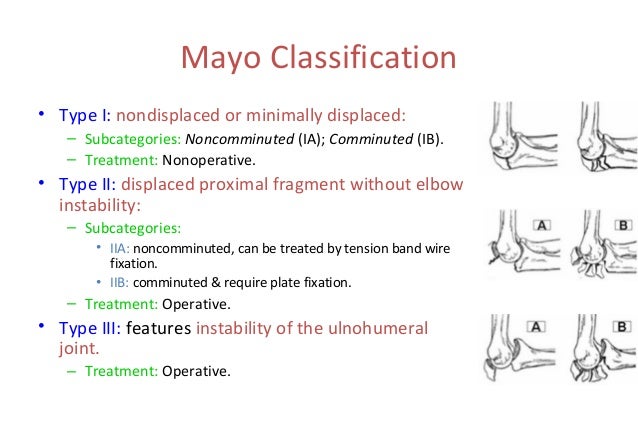 Mayo Classification System Of Olecranon Fractures
