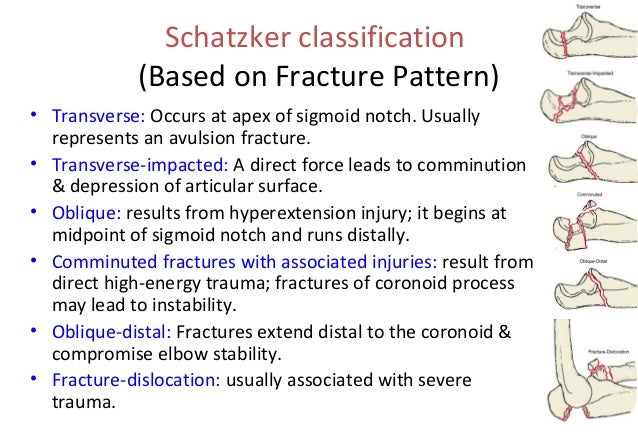 Fractures of the olecranon