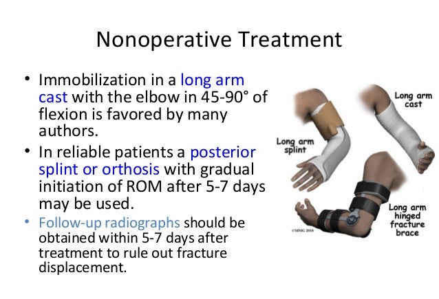 Fractures of the olecranon