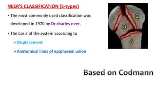 Fractures of the proximal humerus | PPT