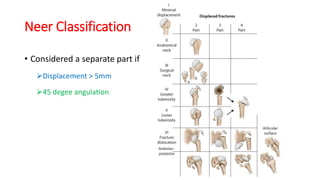 Fractures of the proximal humerus | PPT