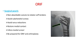 Fractures of the proximal humerus | PPT
