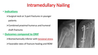 Fractures of the proximal humerus | PPT