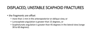 Fractures of the scaphoid | PPTX