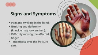 FRACTURES OF THE WRIST AND HAND break in the bones.pptx