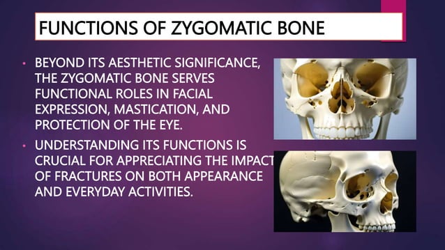 FRACTURES OF THE ZYGOMATIC BONE AND ZYGOMATIC ARCH.pptx